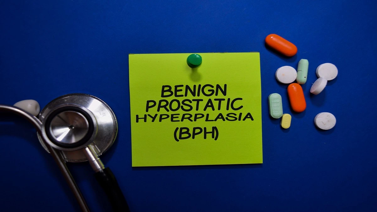 Benign Prostatic Hyperplasia Medication | BPH Relief Options